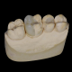 ¿Qué son los cerómeros? – Dentalaic